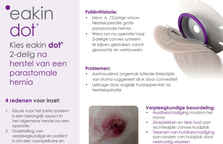 Case study's - Eakin